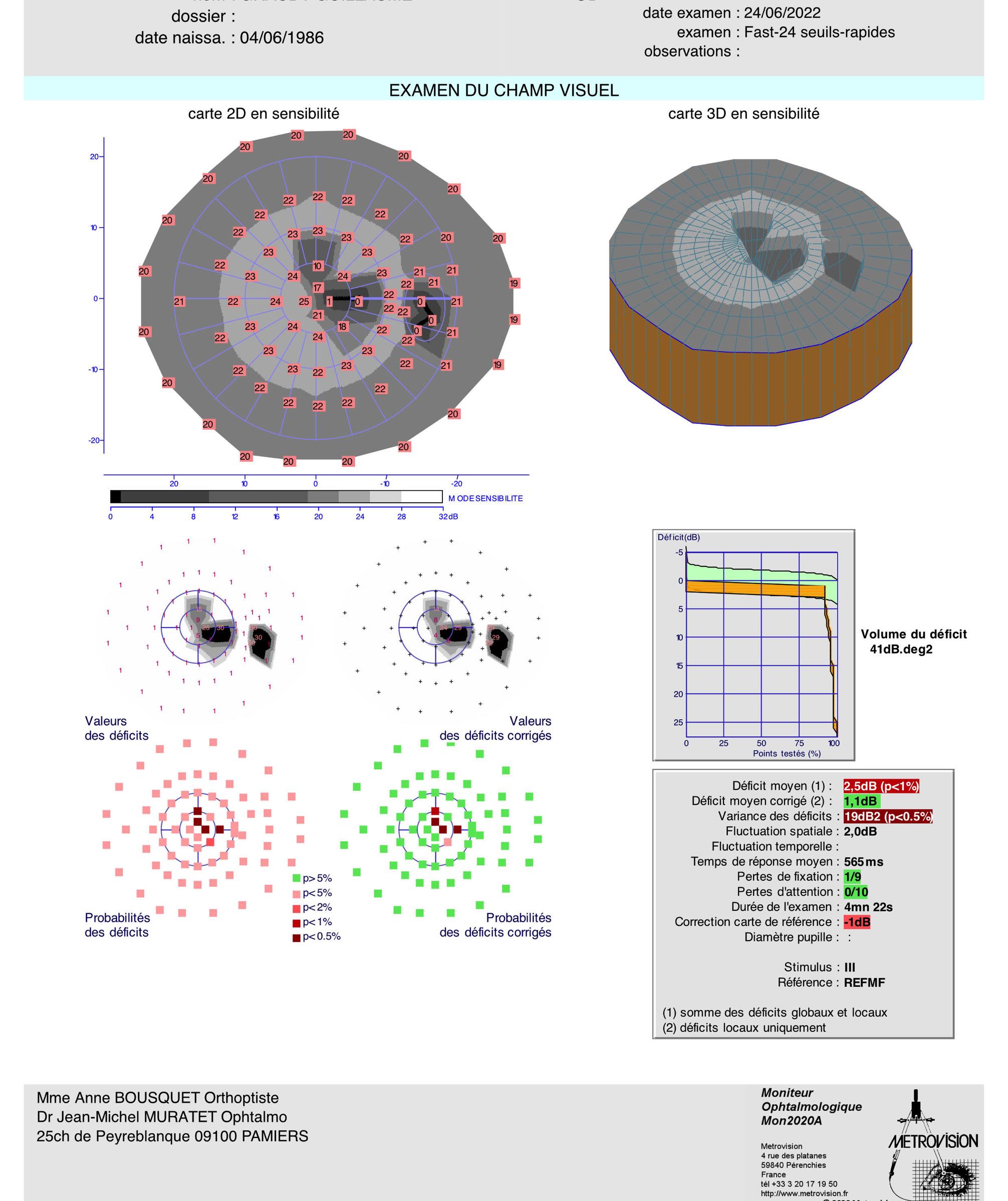 Acute Macular Neuroretinopathy (Covid) Eidon